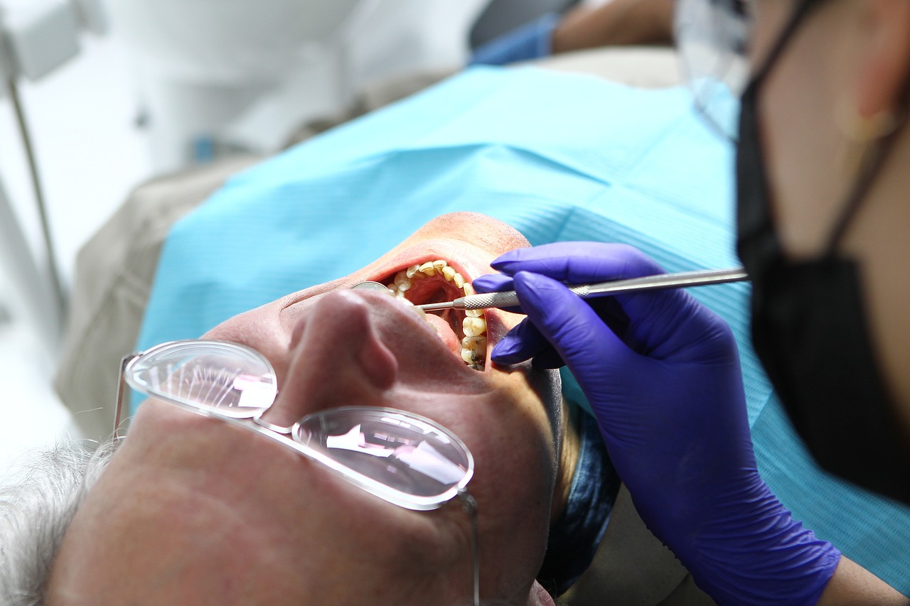 Deep Teeth Cleaning Rockville, MD | Scaling & Root Planning